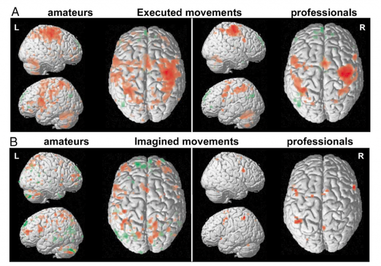 Professional musicians display more focussed brain activation than ...