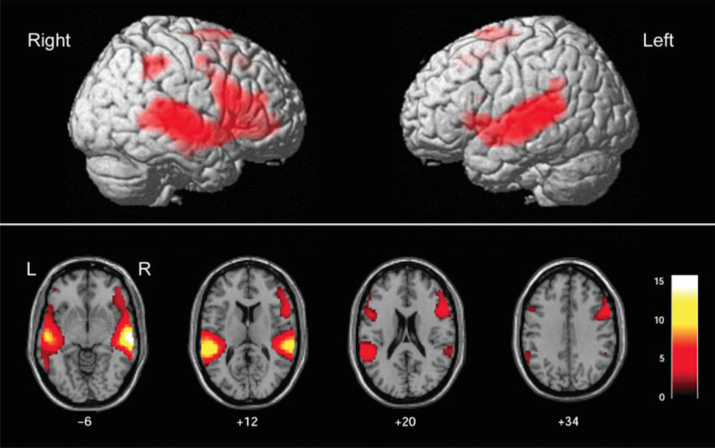 Rhythm stimulates the 'language brain' in musicians and the 'movement ...